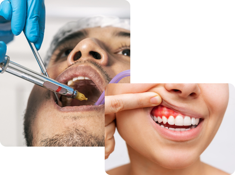 Teeth Cleaning Cumming GA